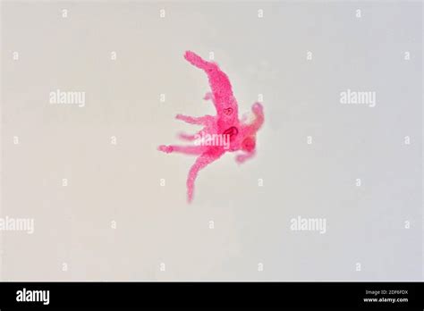 Amoeba Proteus Microscope Slide