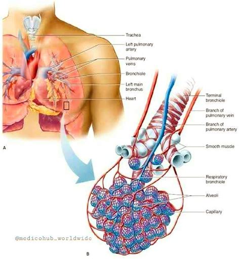 What Is Lung Parenchyma Made Of At Charlotte Lucero Blog