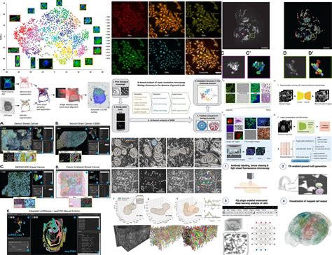 Microscopy Preprints Bioimage Analysis Tools Focalplane
