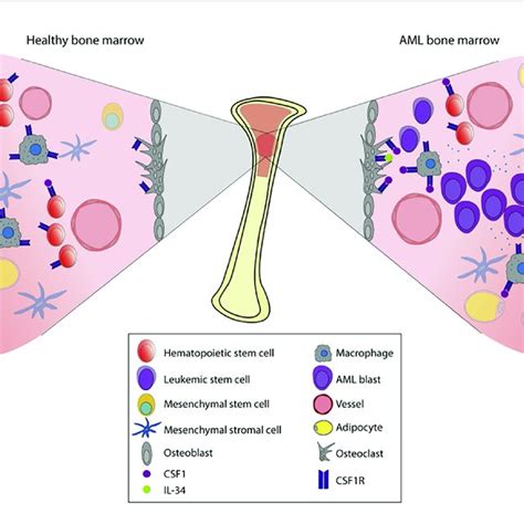 Pathophysiology Of Aml In The Bone Marrow The Bone Marrow Is A Download Scientific Diagram