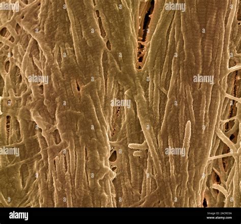 False Coloured Scanning Electron Micrograph Of Cortical Bone Compact