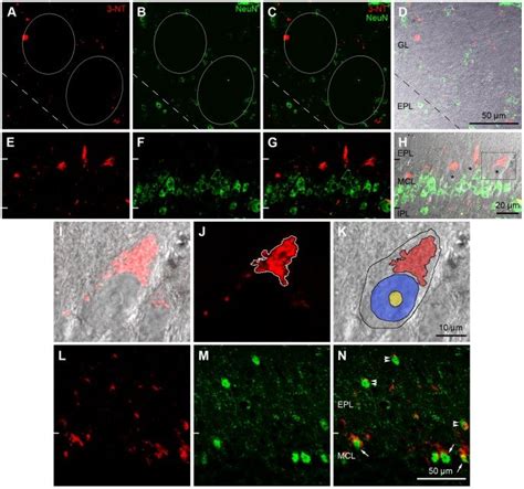 A Small And Large 3 Nt Labeled Puncta Red Are Seen Within The
