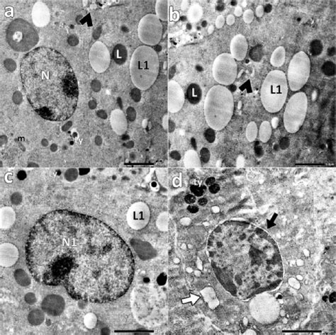 Electron Photomicrograph Of Iat Of Hfd Brl Subgroup Showing A C