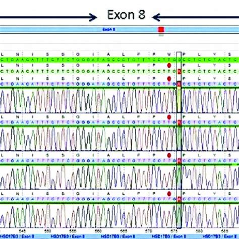 Electropherogram Of Sequencing Data Of Exon Eight Of The Hsd17b3 Gene
