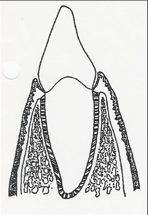 Periodontium Lecture Notes Diagram Quizlet