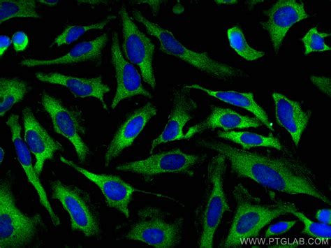 Dspp Antibody 55396 1 Ap Proteintech