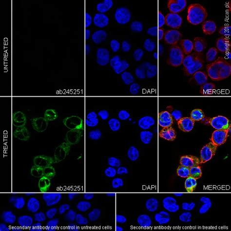 Anti Ccl3 Mip 1 Alpha Antibody Epr19900 147 Ab245251 Abcam