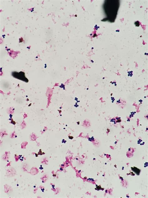 Staphylococcus Lugdunensis 〔黄色ブドウ球菌なcns〕 グラム染色 Gram Stain