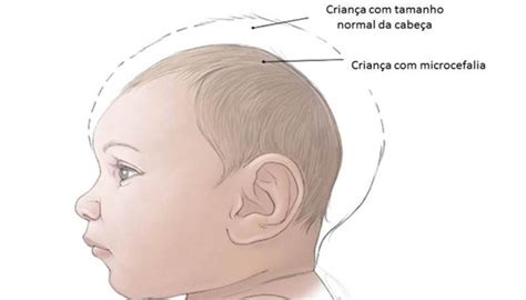 Ciências Biologia Química Vírus Zika