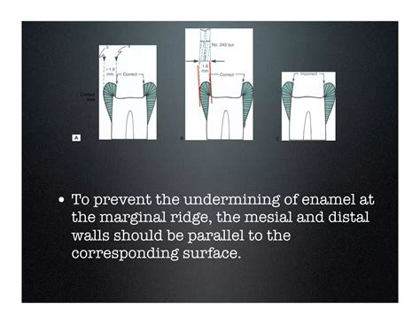 Amalgam Cavity Preparation Class I Pdf