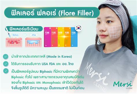 Flore Filler ฟลอเร่ ฟิลเลอร์ จากเกาหลีดีไหม ต่างจากยี่ห้ออื่นอย่างไร