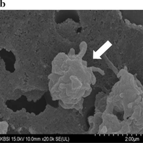 Scanning Electron Microscopy Sem Of The Platelets At Different Download Scientific Diagram