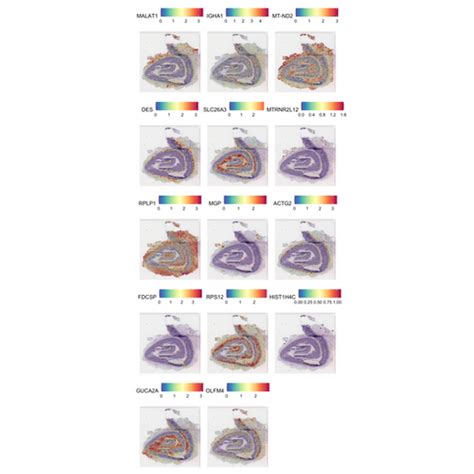 Spatial Colon Sigmoid