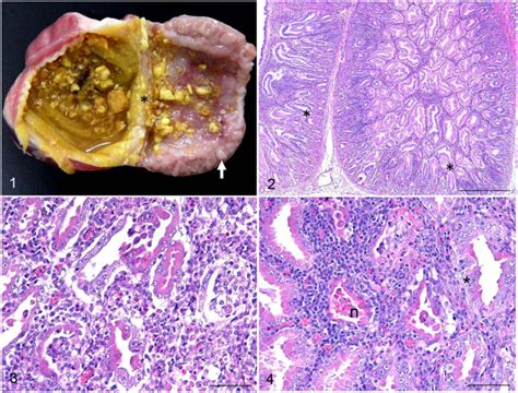 Retrospective And Prospective Studies Of Transmissible Viral