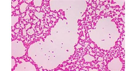 Proteus Gram Stain