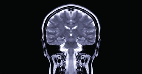 Racgp Ajgp Australian Journal Of General Practice