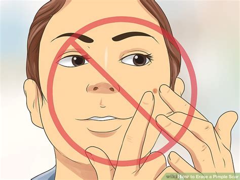 Ways To Erase A Pimple Scar Wikihow