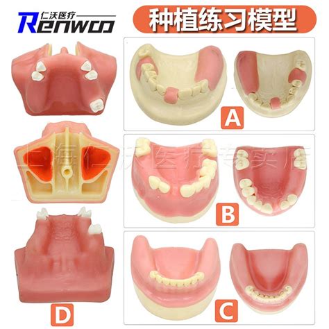 Maxillary Sinus Lifting Exercise Teeth Model Dental Implant Practice