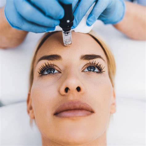 Microneedling Athens Ga Blue Spiral Medical Spa