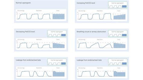 Basic Waveform Capnography As A Continuous Monitoring Tool During