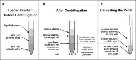 Density Gradient Separation Of Sperm For Artificial Insemination