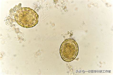 A Variety Of More Serious Stool Abnormalities Check To See Which Physical Problems Reflect Inews