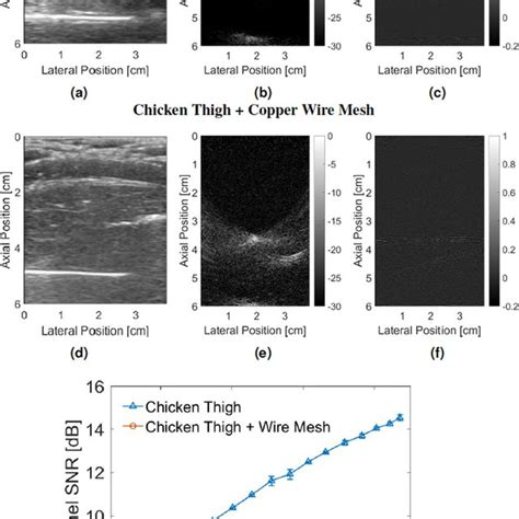 Effect Of Acoustic Clutter Demonstrated With A Ultrasound Image Of An Download Scientific