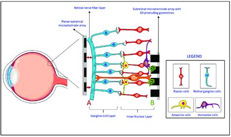 A The Lack Of The Topographical Alignment Between A Planar Epiretinal Download Scientific