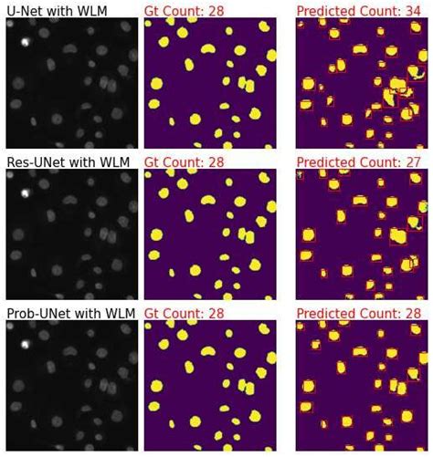 qualitative results on the kaggle dataset [32] column 1 shows the