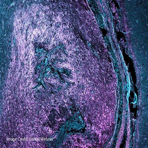 Electron Microscopy Sciences On Linkedin Sfn23 Emshasit Histology