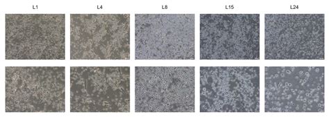 Human Liver Spheroids From Peripheral Blood For Liver Disease Studies