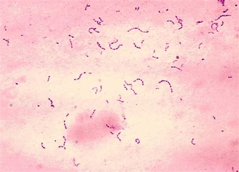 Bacterial Morphology Microbiology Learning The Whyology Of