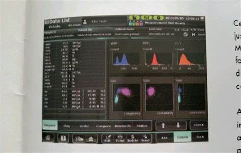 Immunoassay Analyzer Clia 181 J Mitra Trader Retailer From