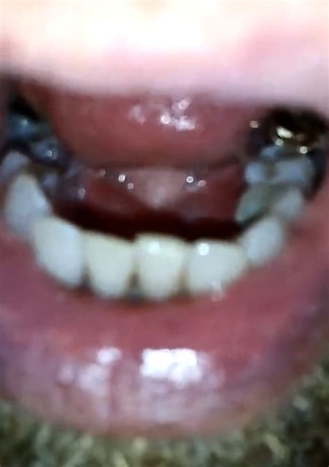 Mouth And Vore Fetish Mouth And Vore Fetish