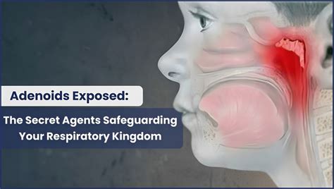 Adenoid Adventures 1exploring The Unsung Heroes Of Immunity
