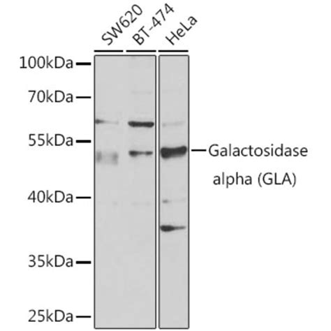 Anti Galactosidase Alpha Antibody A13602
