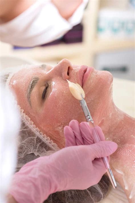 Peeling Químico Facial Profundo Centros Looks Málaga