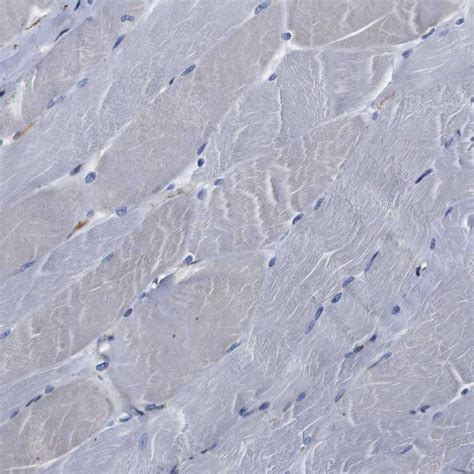Rabbit Polyclonal Anti Ppib Antibody Buy For Research Highly Specific Rigorously Validated
