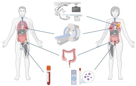 Shifting The Cancer Screening Paradigm The Rising Potential Of Blood