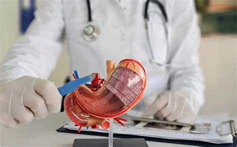 Symptoms For Sleeve Resection Surgery Medisuggest