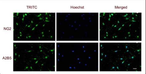Purified Oligodendrocyte Precursor Cell Opc Cultures From P0 Rat Download Scientific Diagram