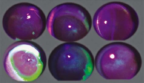 Illustrative Presentation Of The Course Of Corneal Defects With 0 5 Download Scientific