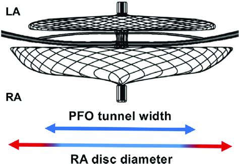 Pfo Sizing And Device Size Selection Schematic Based On Tunnel Width Download Scientific
