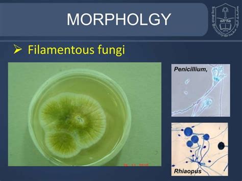 10 Fungi And Their Pathogenesis Ppt Ppt