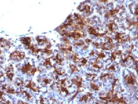 Anti Maml3 Antibody Maml31303 Ab218492 Abcam