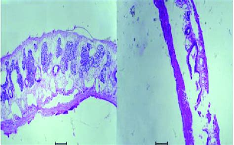 A Longitudinal Section And B Cross Section Of Fasciola Sp In