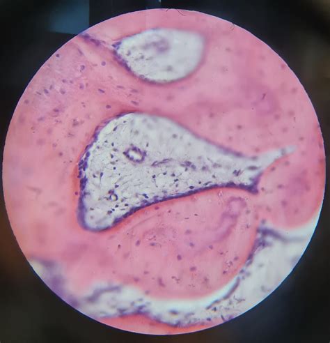 Intramembranous Ossification Diagram Quizlet