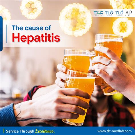 The Cause ทีแอลซี อุดรแลบเซ็นเตอร์tlc Udon Lab Center