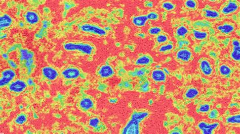 New Breast Cancer Tissue Biomarker Nci