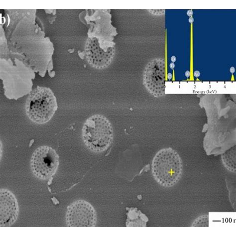 The Microstructure Of Diatomite And Tio2diatomite Composite